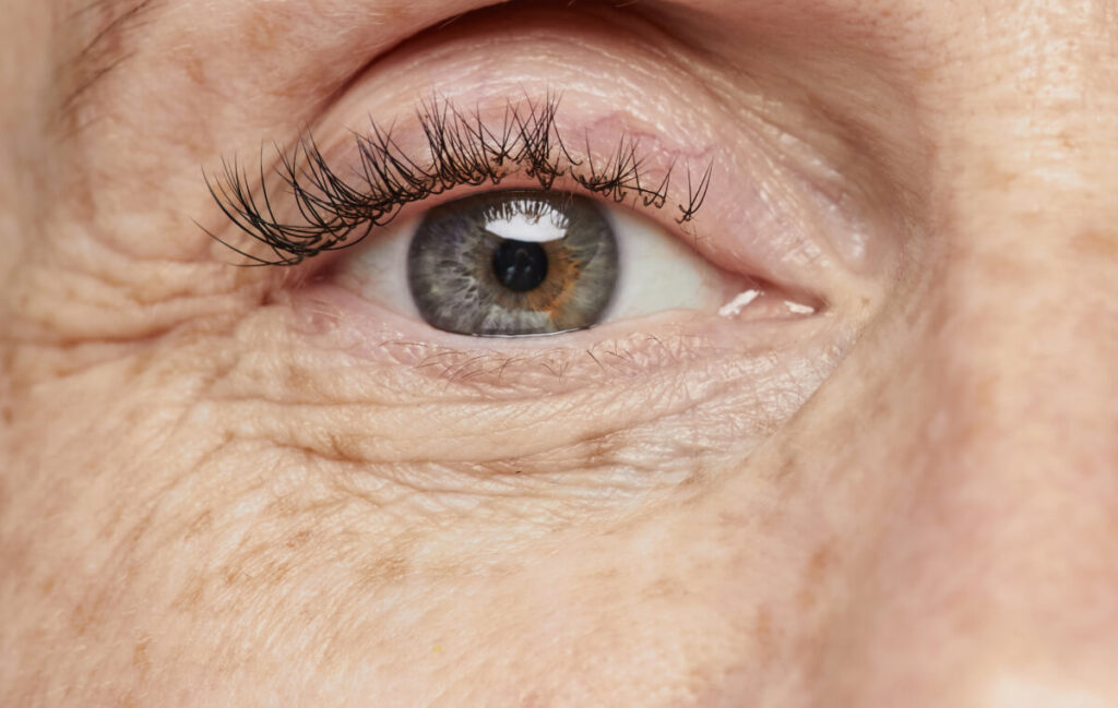 What is Photoaging? Everything You Need to Know